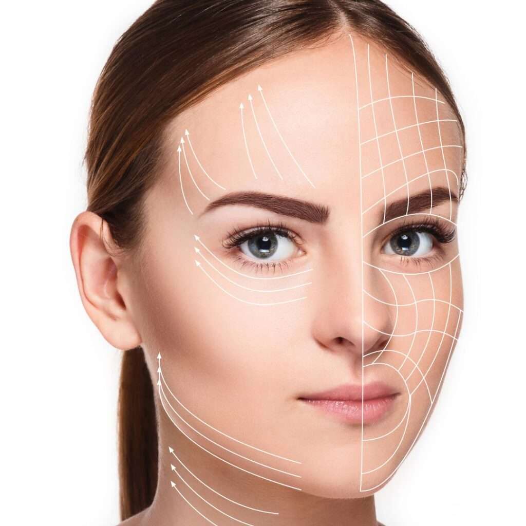 Thread Lift (face & Neck & body) - Medical Treatments - Dubai - Swan ...