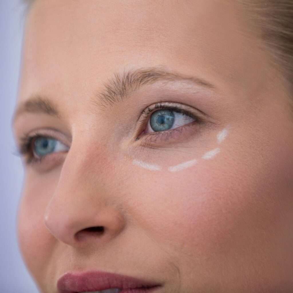 Under Eye Brightening and Dark Circle Treatment - Skin Treatments ...