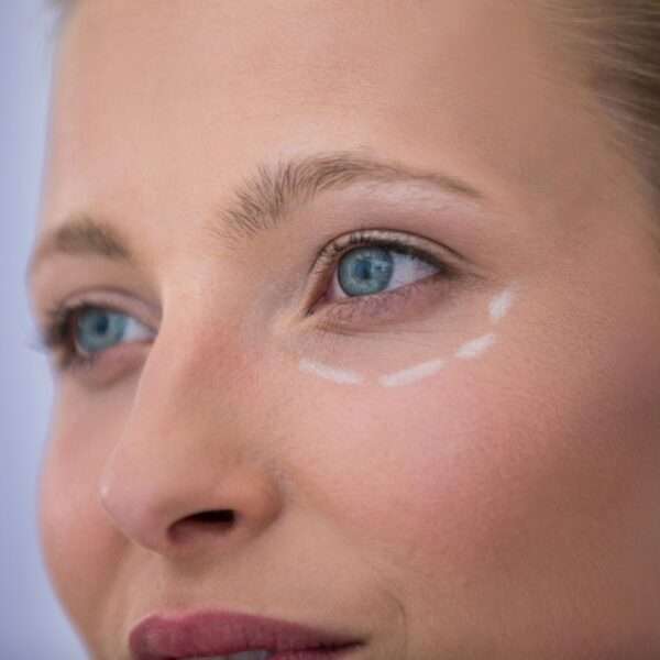 Under Eye Brightening and Dark Circle Treatment - Skin Treatments ...