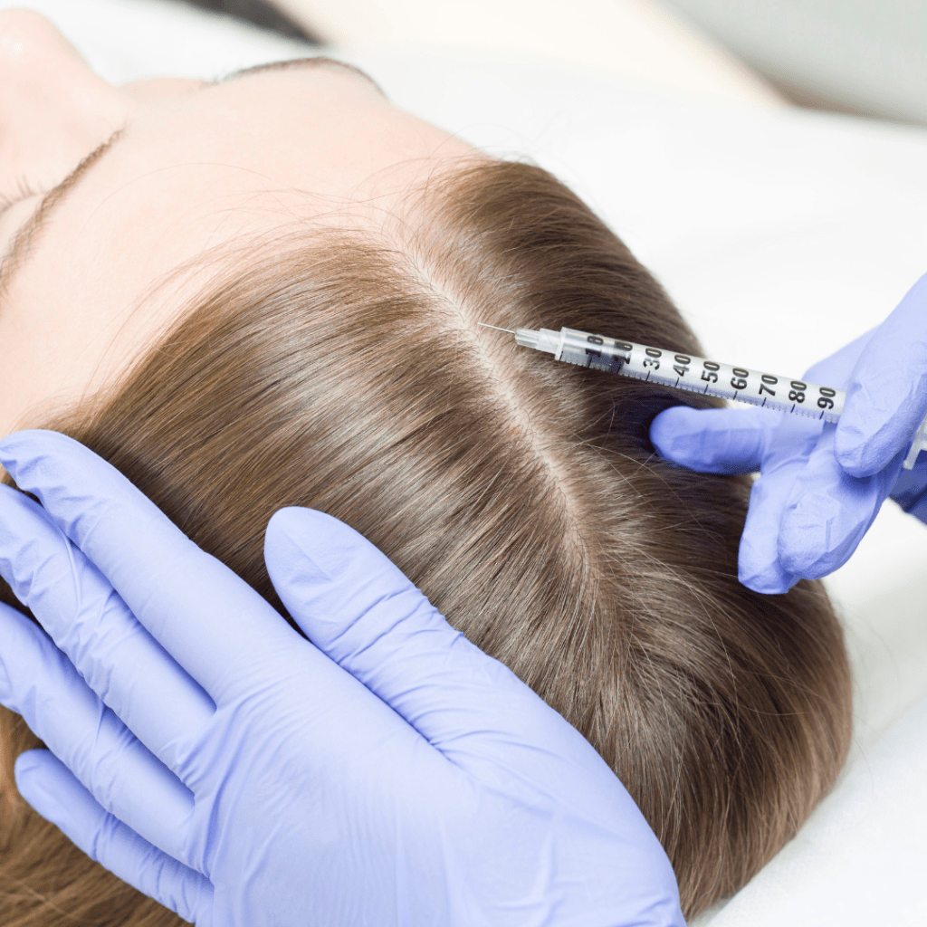 Hair Filler - Hair Growth Treatments - Dubai - Swan Aesthetic Clinic