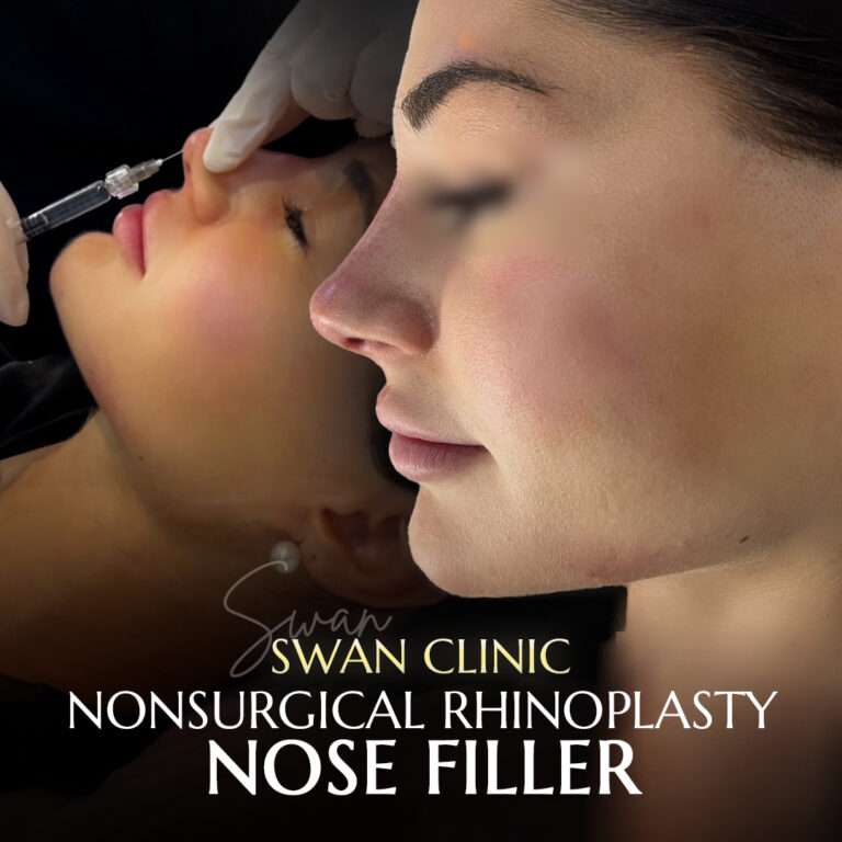 Facial Treatments Archives - Dubai - Swan Aesthetic Clinic