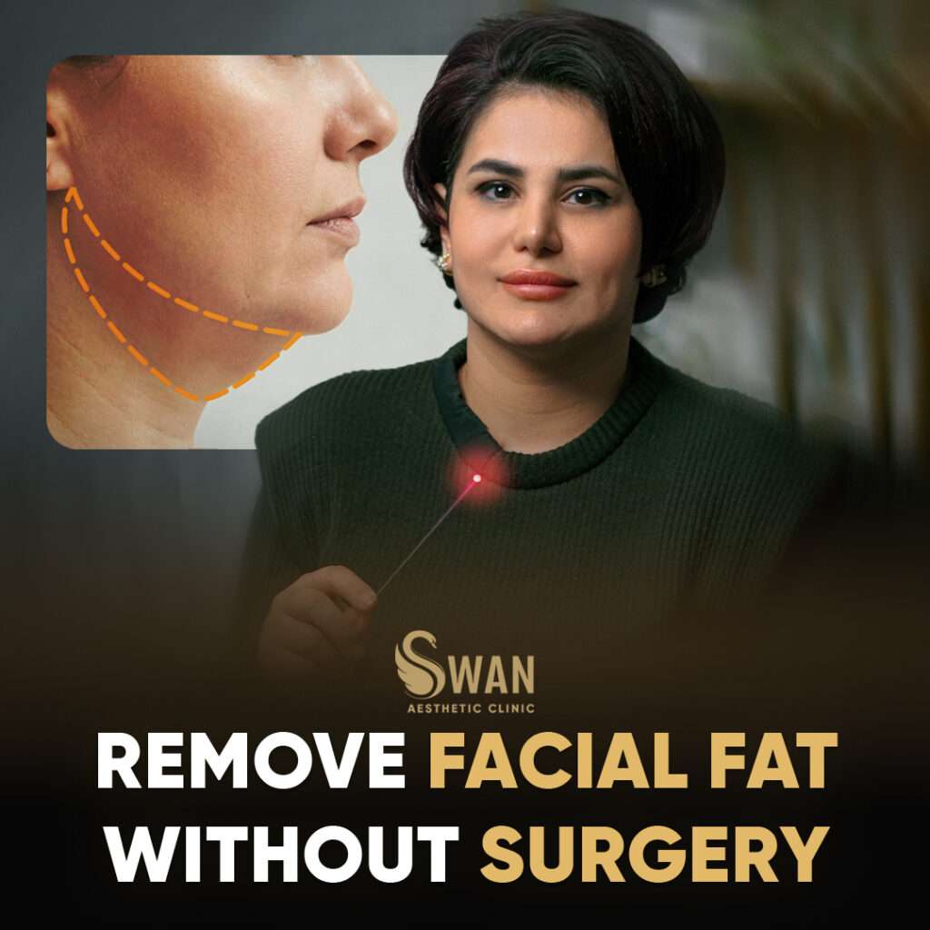 Remove Facial Fat Without Surgery: Precision Endolift Treatment in ...