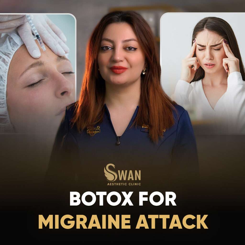 Botox For Migraine Treatment In Dubai - A Medical Approach To Chronic ...